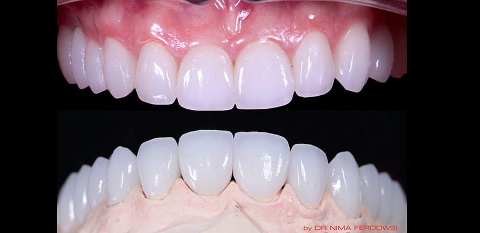 Digital Smile Design - Design Your Smile With Bond Street Dental